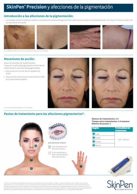 SkinPen Precision y Afecciones de la Pigmentación - Real Lasting
